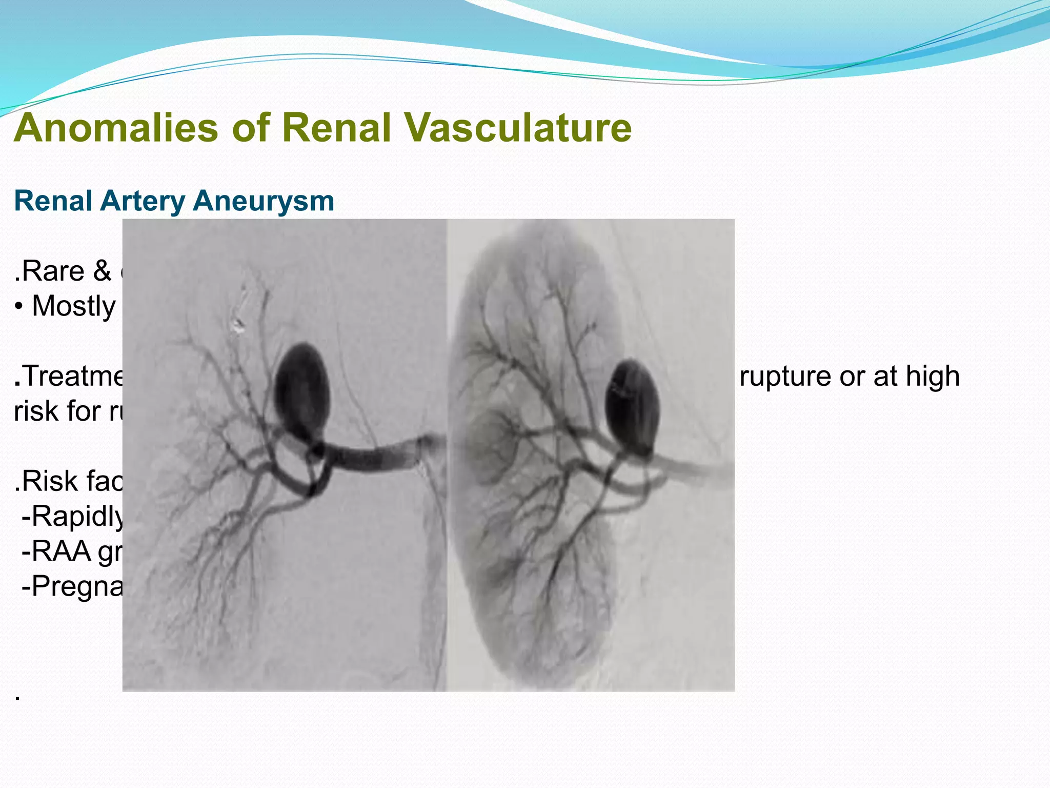 Renal anomalies | PPTX