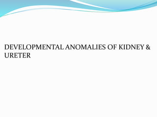 Renal anomalies | PPTX