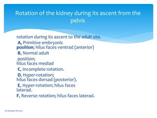 Renal anomalis | PPTX