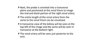 Renal artery Doppler and renal transplant | PPTX