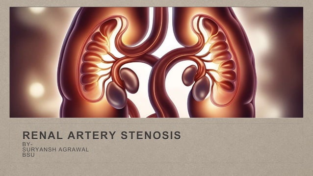 Renal artery stenosis. . . | PPTX