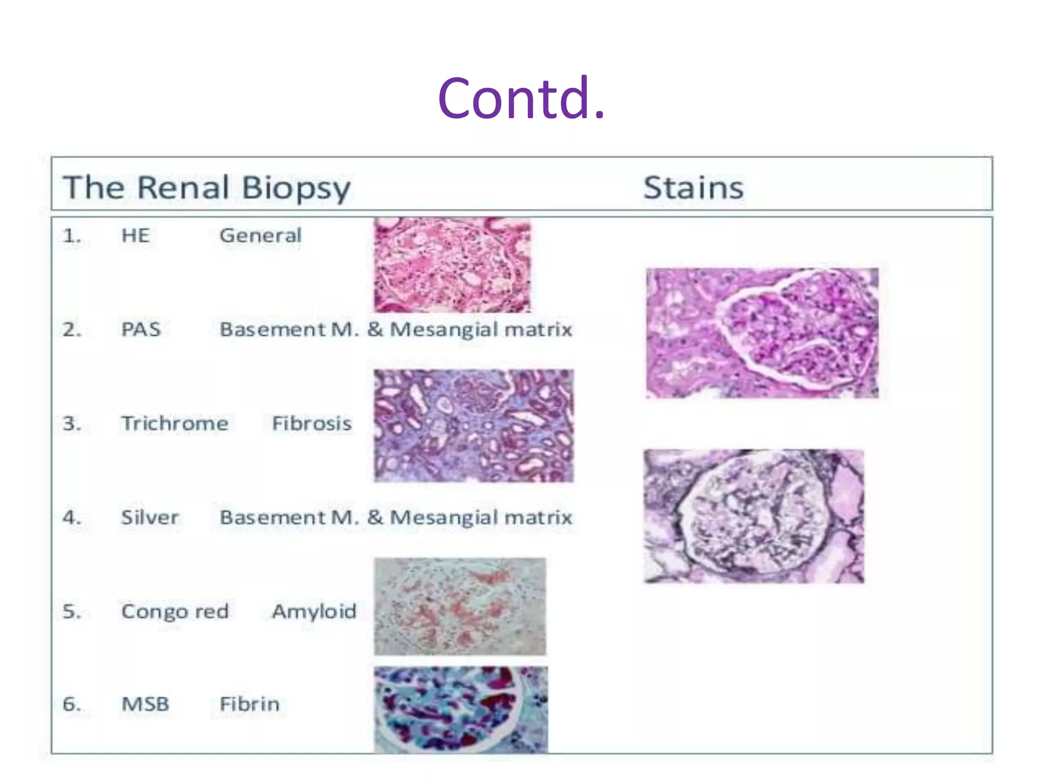 Renal biopsy.pptx