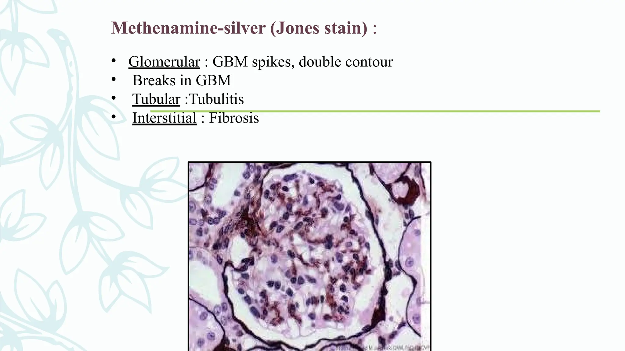 RENAL BIOPSY presentation and lecture on | PPTX