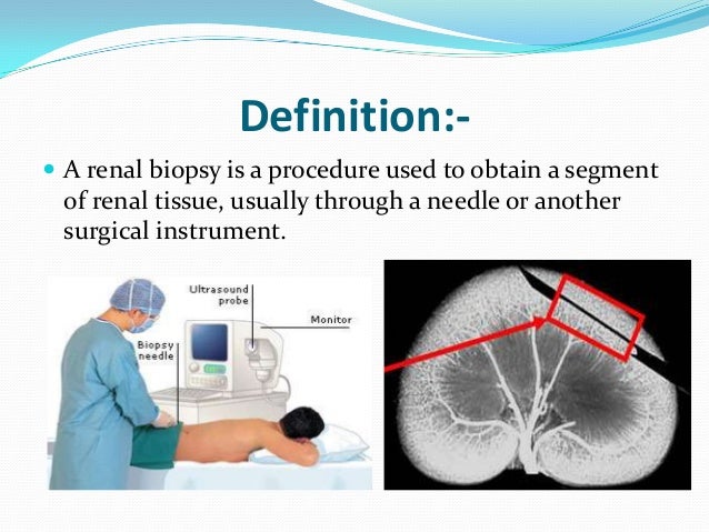 Renal biopsy fadl