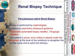 Renal biopsy, nadia | PPT