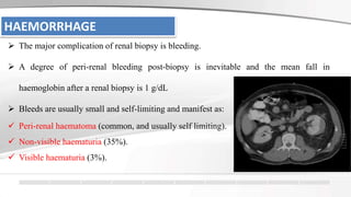 ultrasound guided renal biopsy.pptx