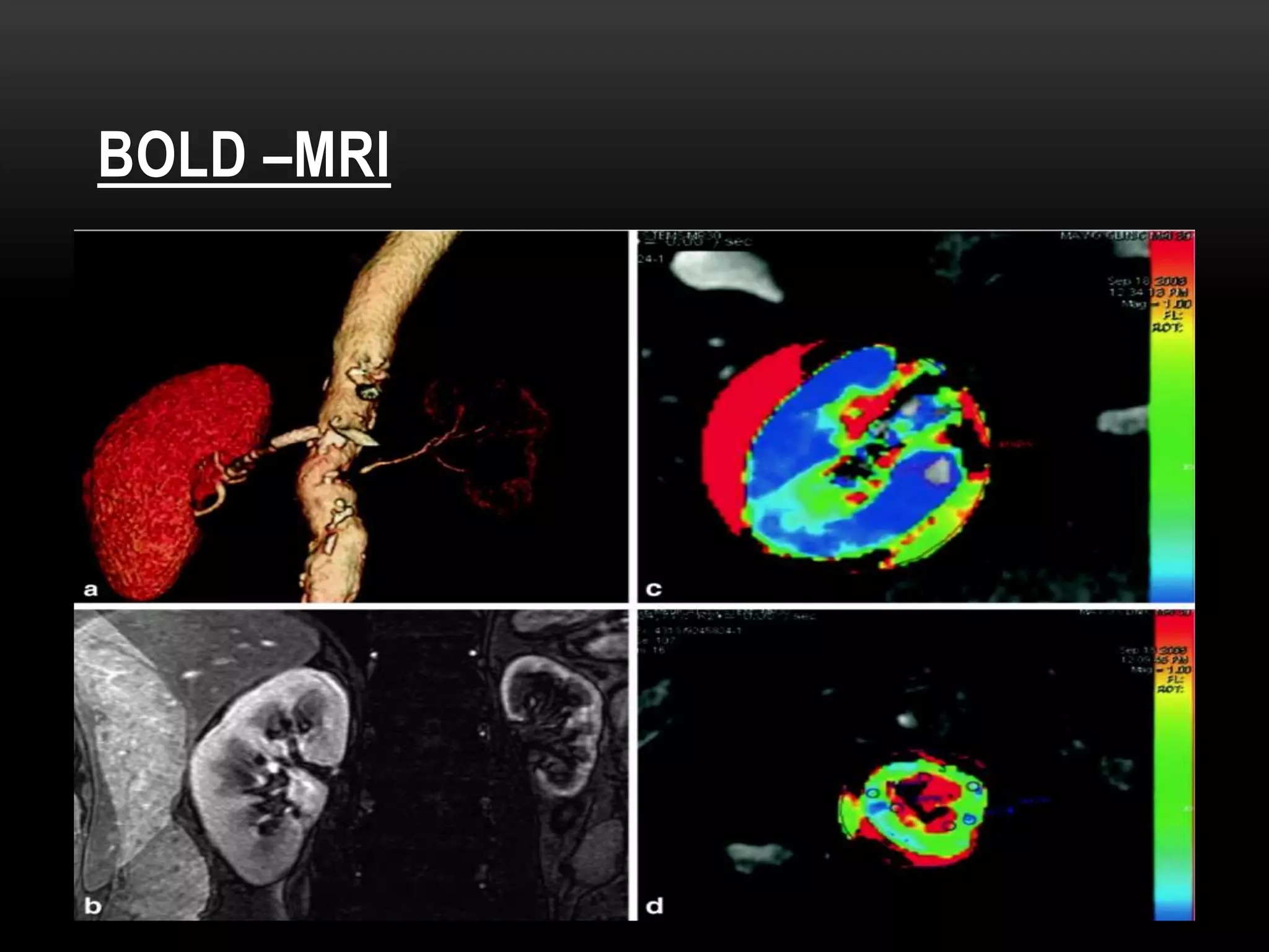 Renal blood flow and perfusion | PPT
