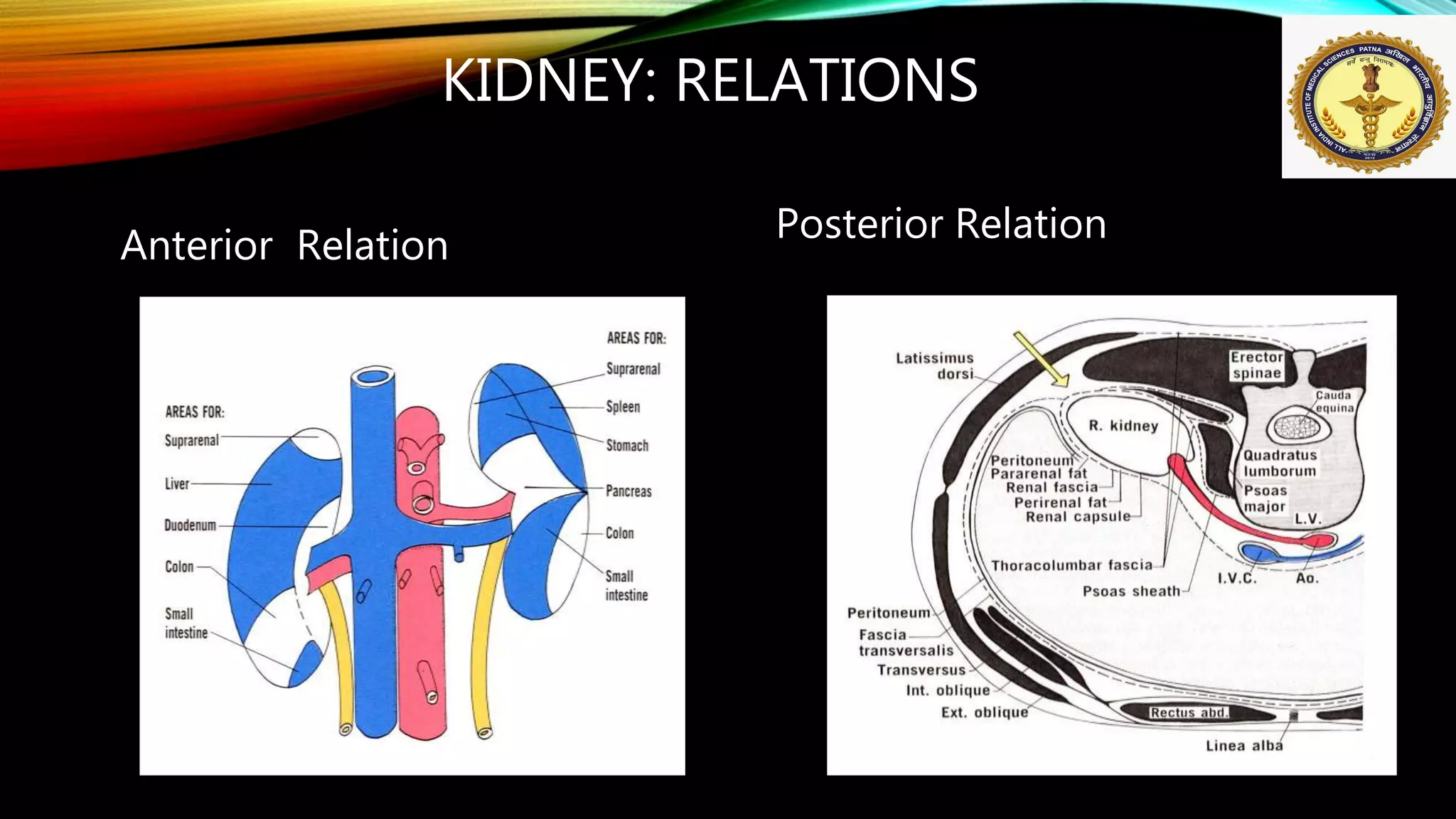 Renal stone by Dr Anil Kumar, Assistant Professor, AIIMS-Patna | PPTX