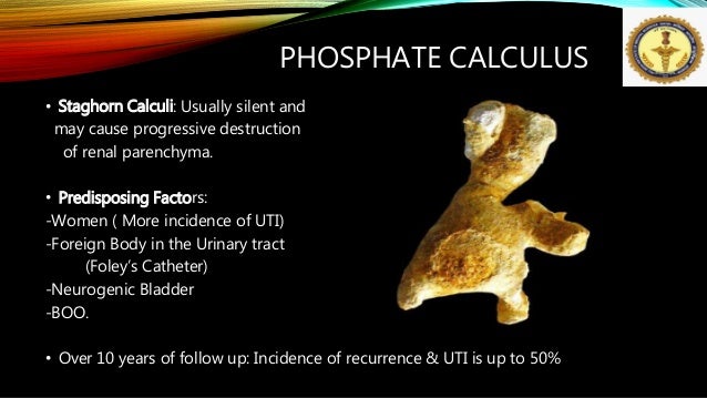 Renal stone by Dr Anil Kumar, Assistant Professor, AIIMS-Patna