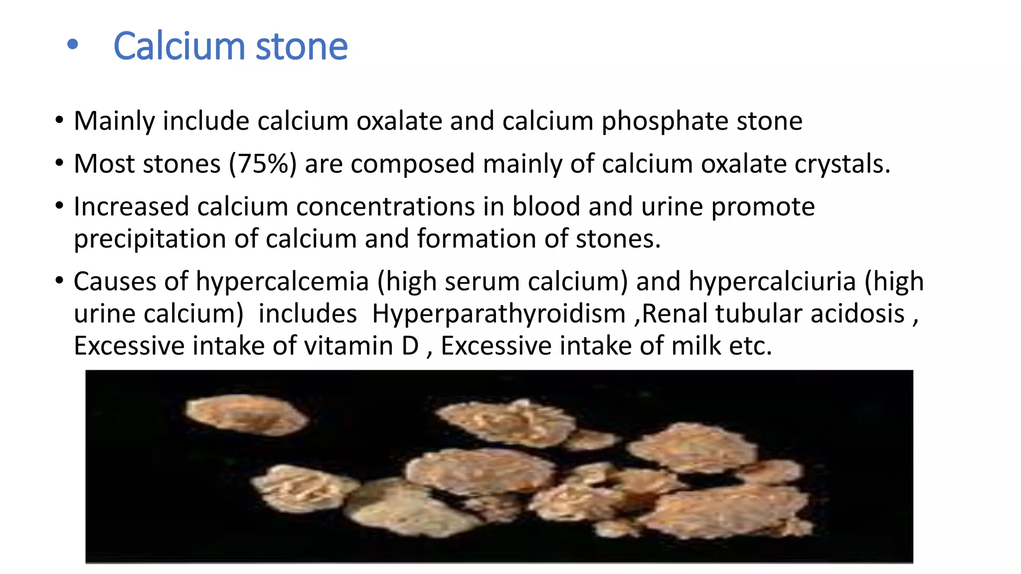 Renal calculi | PPTX