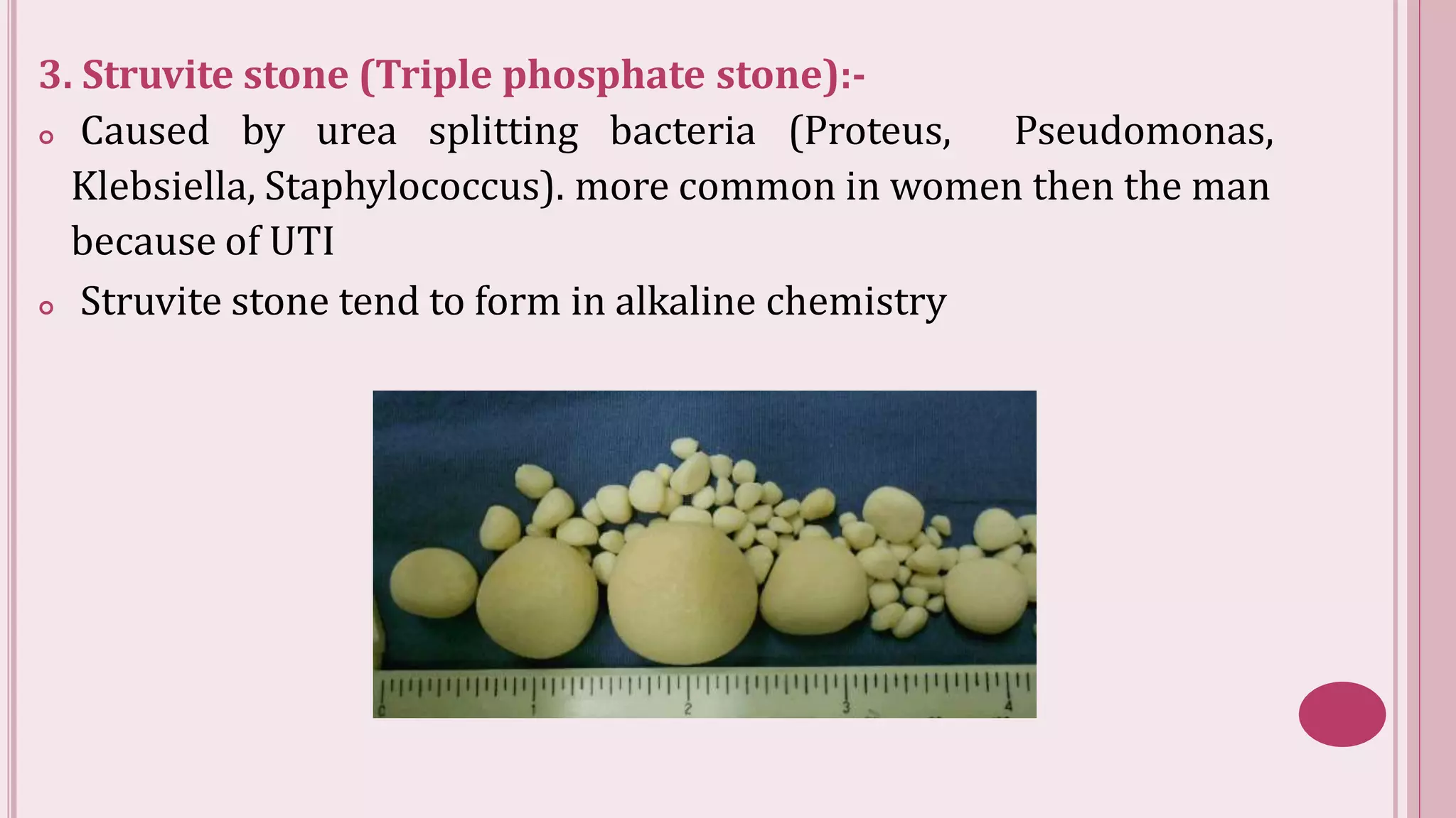 RENAL CALCULI | PPTX
