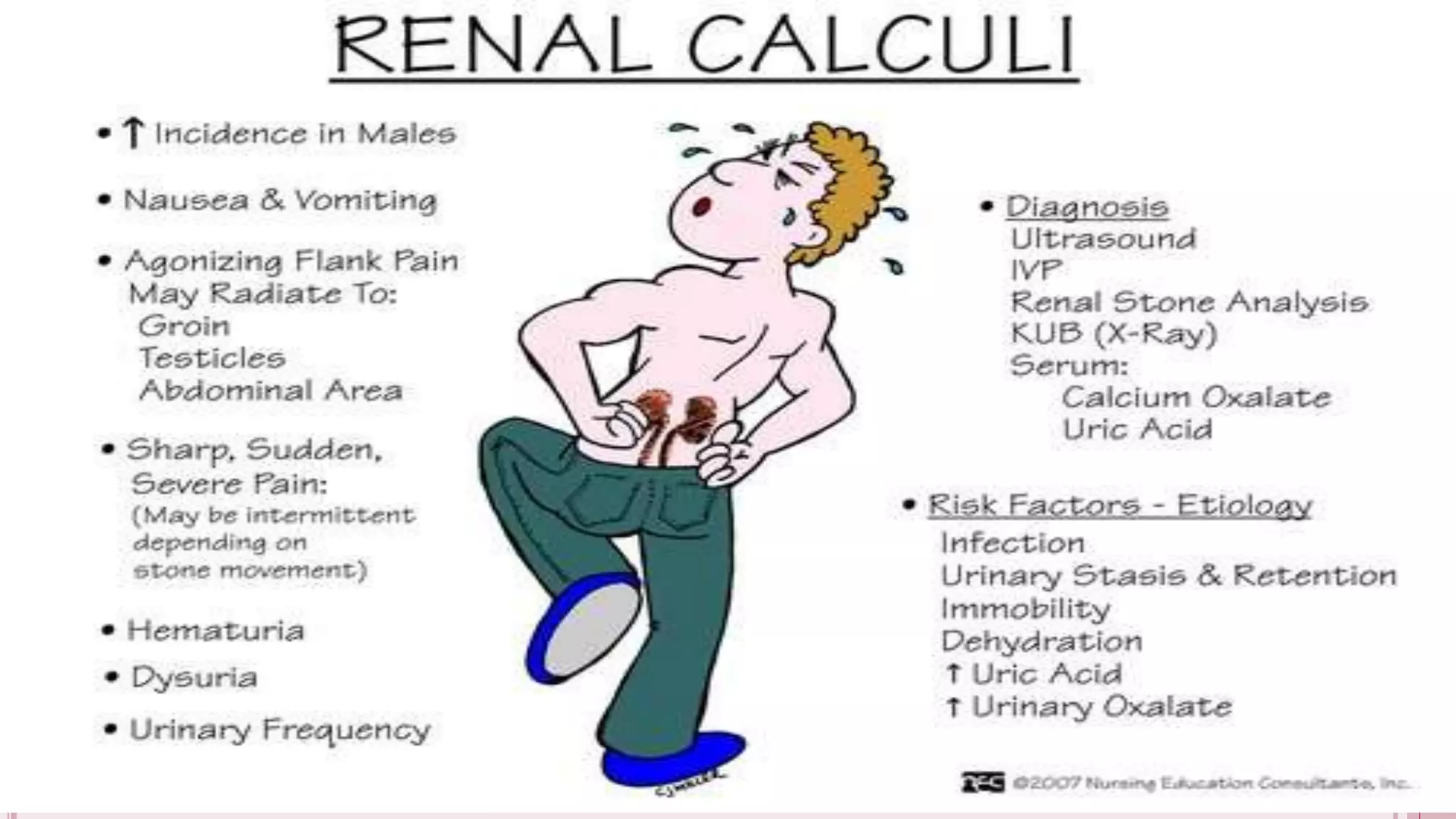 RENAL CALCULI | PPTX