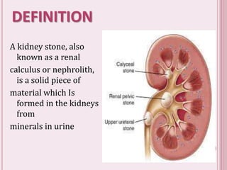 Renal calculi | PPT