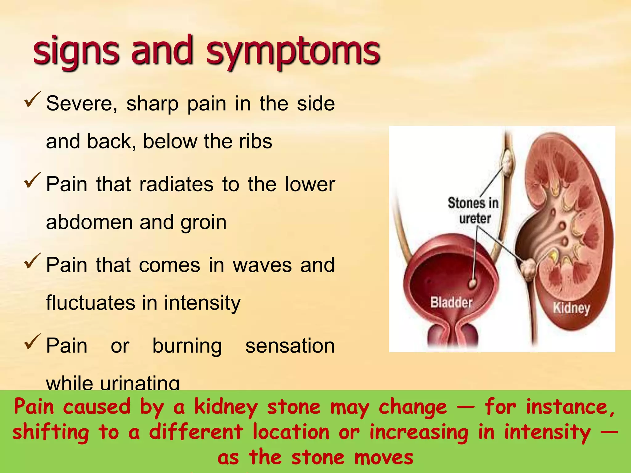 Renal calculi | PPTX
