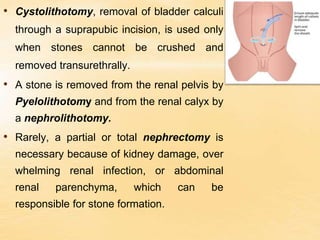 Renal calculi | PPTX