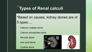 Renal calculi AHN-2 Adult Health Nursing | PPTX