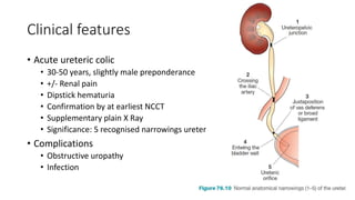 Renal calculi and obstructive uropathy.pptx