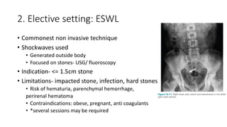 Renal calculi and obstructive uropathy.pptx