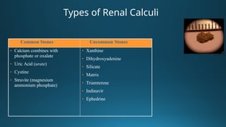 different Renal calculi types and its management | PPTX