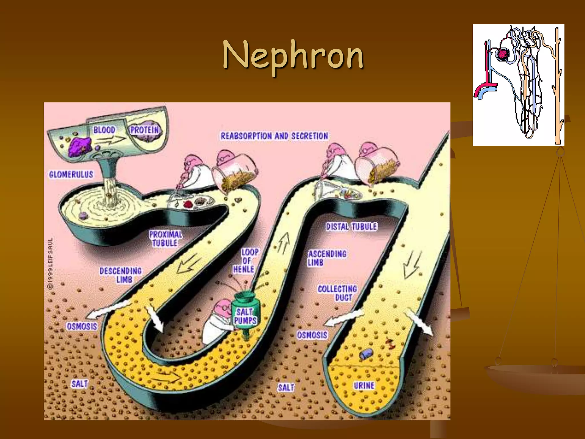 Renal stone disease | PPTX