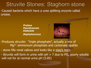 Renal stone disease | PPT