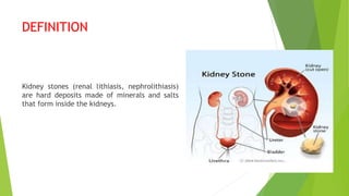 Renal calculus | PPTX