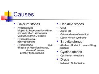 Renal calculus disease | PPT