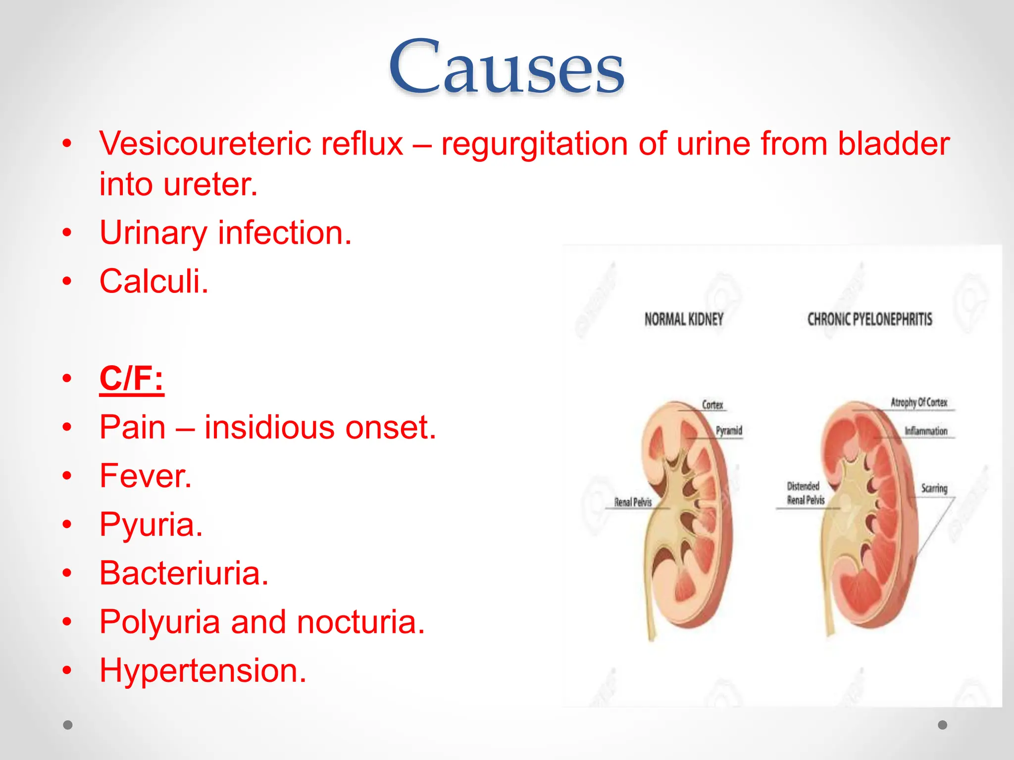 RENAL CALICULI.pptx