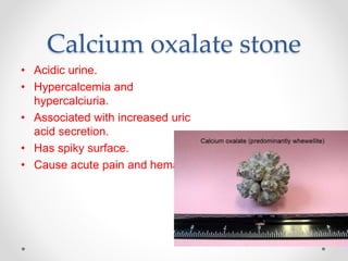 RENAL CALICULI.pptx