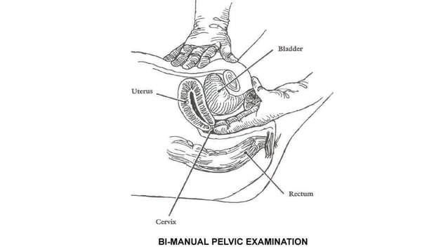 Tumors of kidney and Bladder by Sunil Kumar Daha | PPT