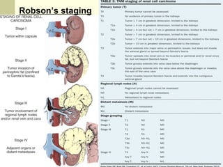 Renal cell carcinoma | PPT