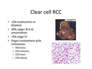 RENAL CELL CARCINOMA .pptx