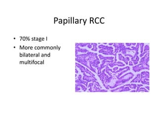 RENAL CELL CARCINOMA .pptx
