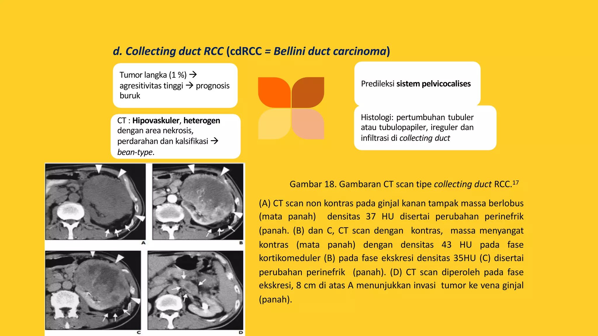 RENAL CELL CARCINOMA - ONCOCYTOMA.pdf