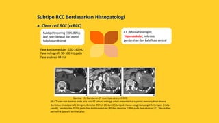 RENAL CELL CARCINOMA - ONCOCYTOMA.pdf