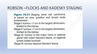 Renal cell carcinoma mgt ppt.pptx