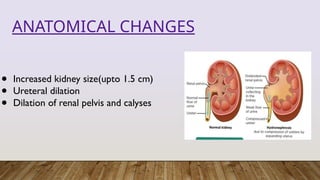 renal changes in pregnancy all effects.pptx