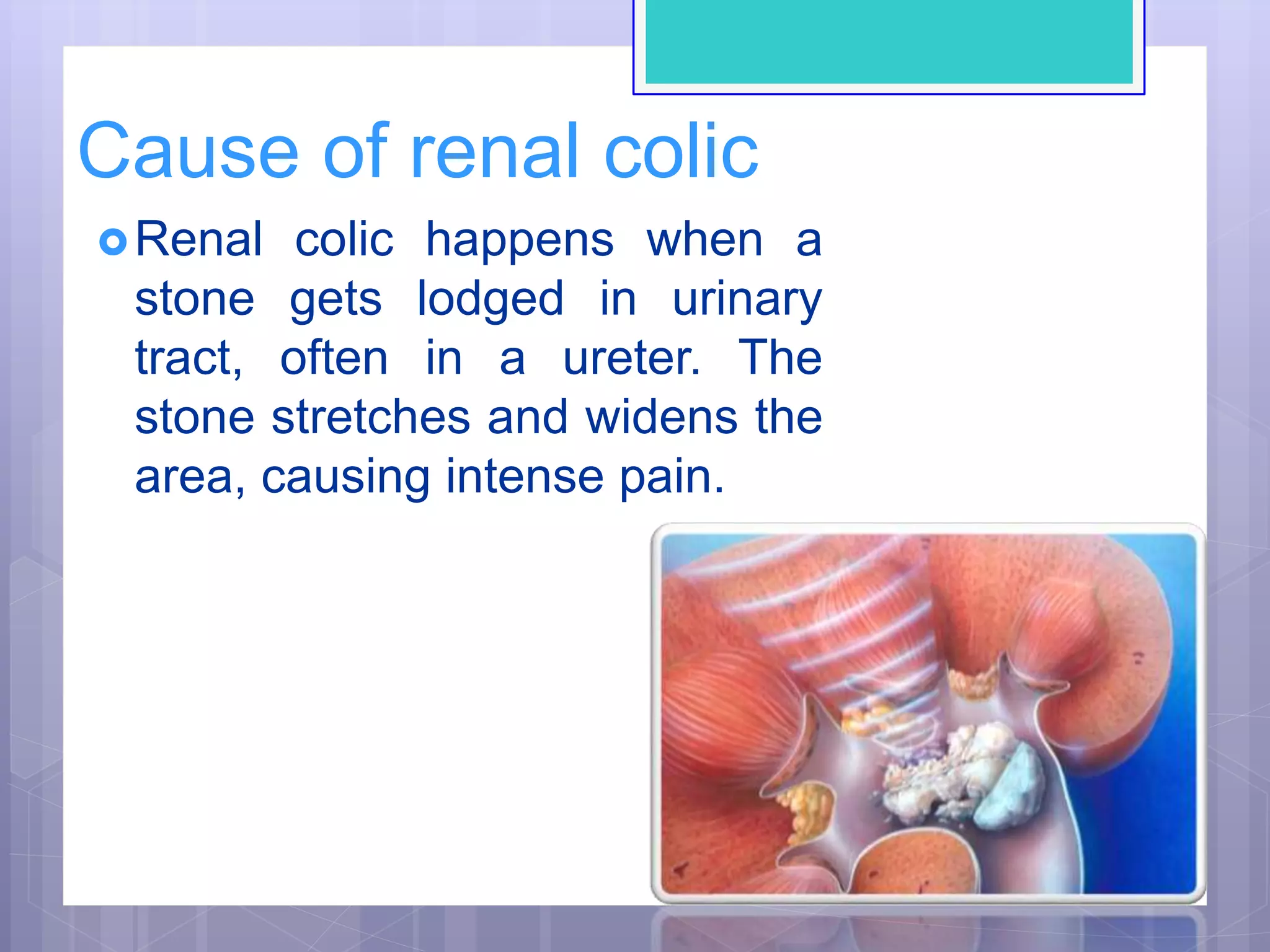 Renal colic | PPTX