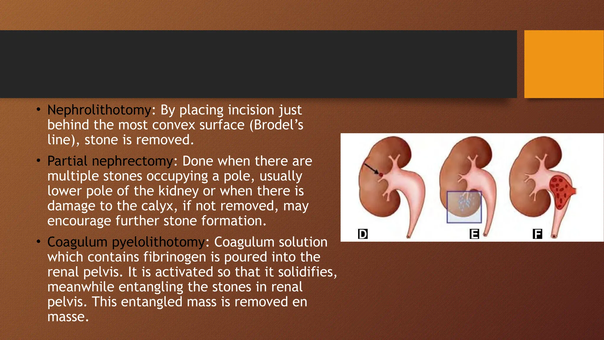Renal colic- Investigations and treatment.ppt
