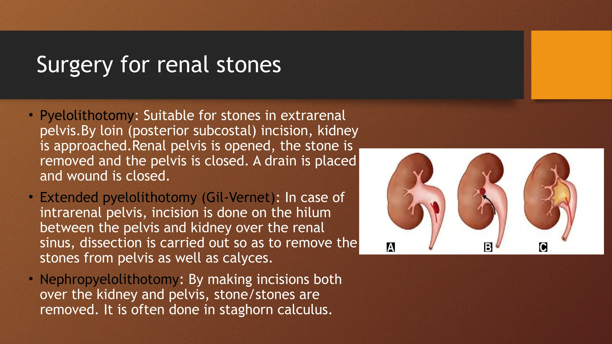 Renal colic- Investigations and treatment.ppt