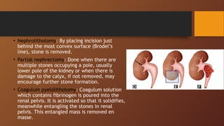 Renal colic- Investigations and treatment.ppt