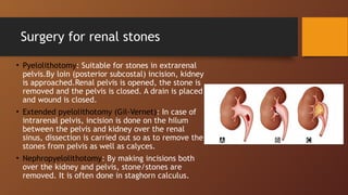 Renal colic- Investigations and treatment.ppt
