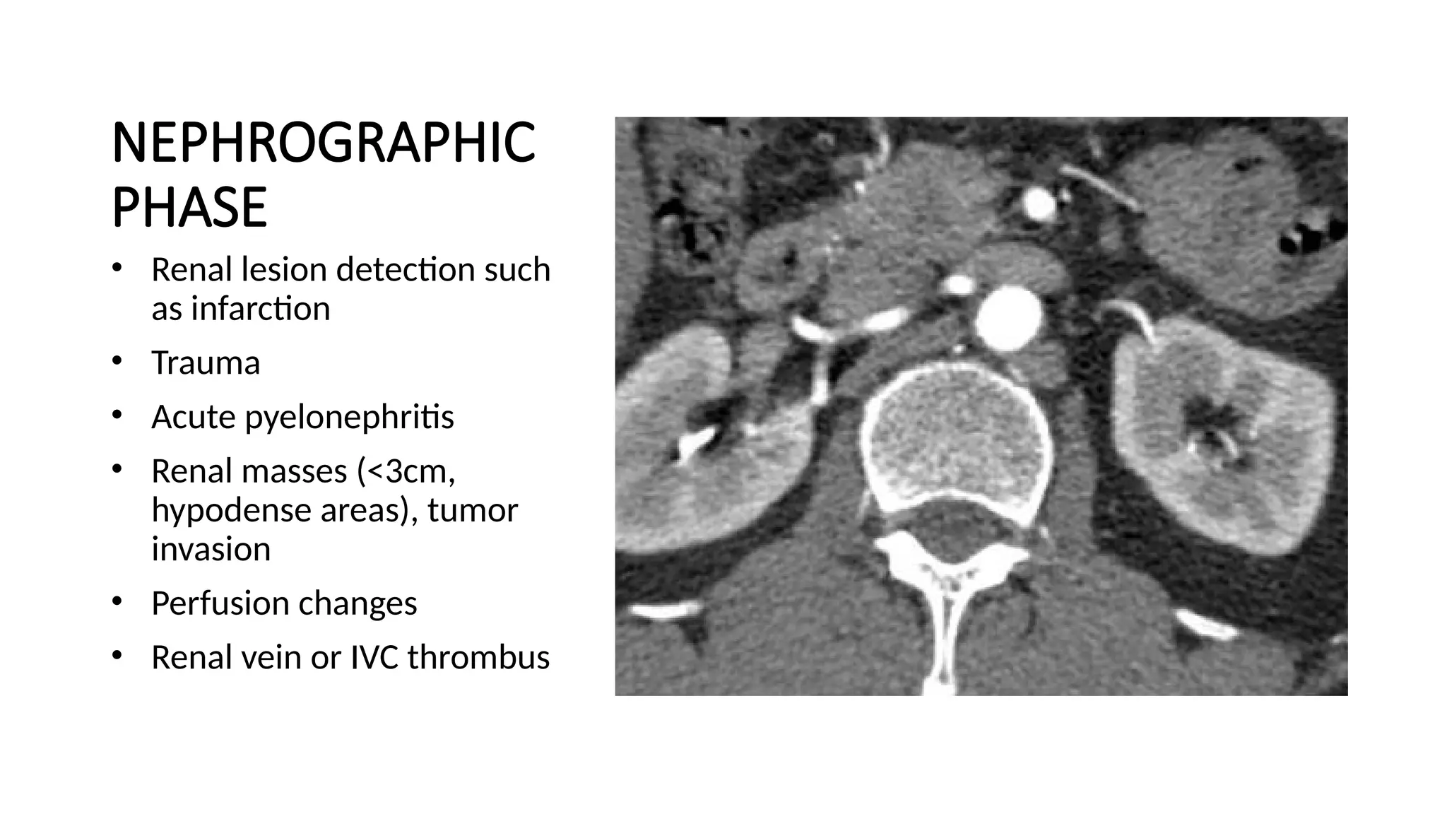 Renal triphasic CT and malignancy .pptx