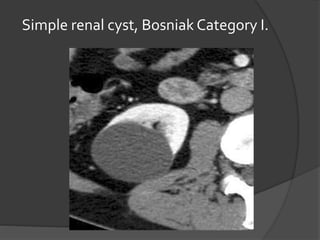 Renal cyst / Classification of Renal Cyst | PPTX