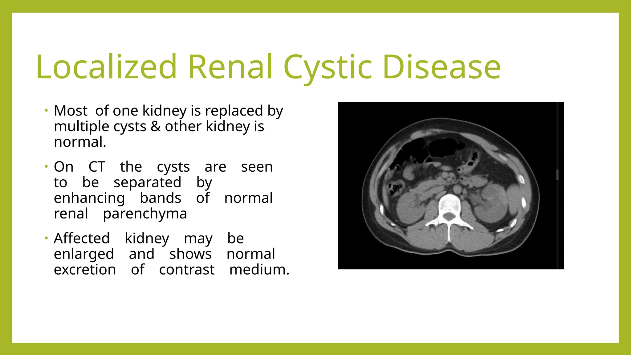 RADIOLOGICAL PRESENTATION OF RENAL CYSTIC DISEASE.pptx