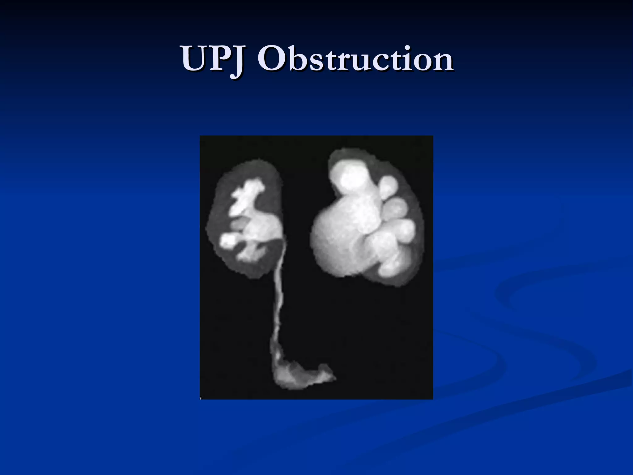 Renal Development Dysplasia 2 | PPT