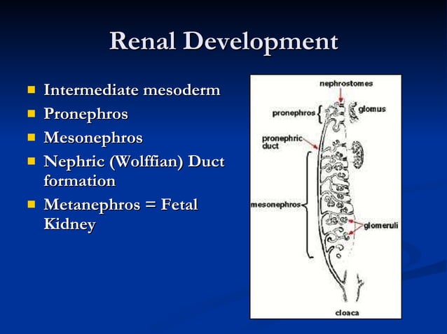 Renal Development Dysplasia 2 | PPT