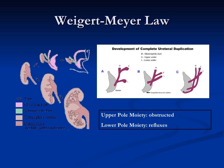 Renal Development Dysplasia 2