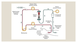 Renal dialysis | PPTX