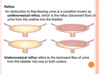 Renal disorders | PPT